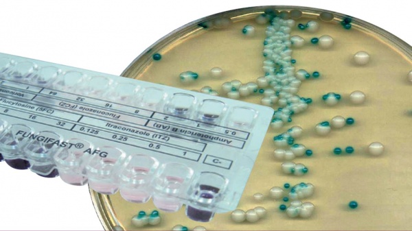 Antifungals Susceptibility Testing Archives - ELITechGroup Microbiology